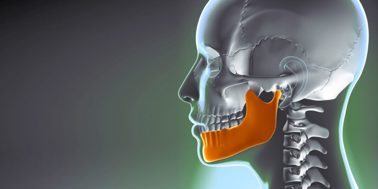 Jaw Surgery Lecanto FL | Corrective Jaw Surgery Spring Hill
